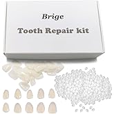 Amazon.com: Fake Tooth Repair Kits for Filling The Missing Broken Tooth ...