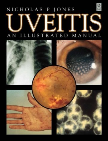 Uveitis: An Illustrated Manual: 9780750654630: Medicine & Health ...