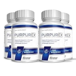 Amazon.com: Purpurex - Reduce Existing Bruises and Bruising Associated ...