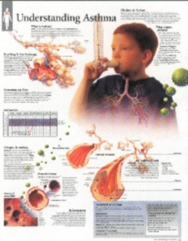 Understanding Asthma chart: Laminated Wall Chart in Kenya | Whizz Pulmonary