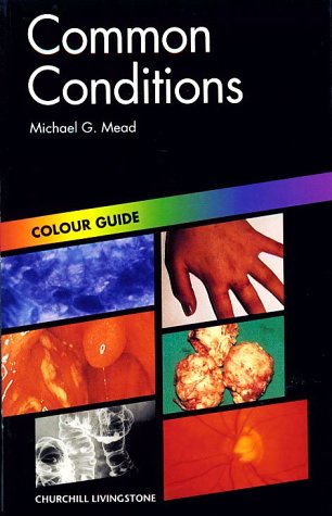 Common Conditions: Colour Guide (Colour Guides): 9780443060212 ...