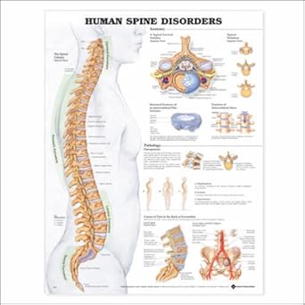 Amazon.com: Human Spine Disorders Anatomical Chart 20" x 26 ...