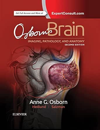 Amazon.com: Osborn's Brain E-Book eBook: Osborn, Anne G., Hedlund, Gary ...