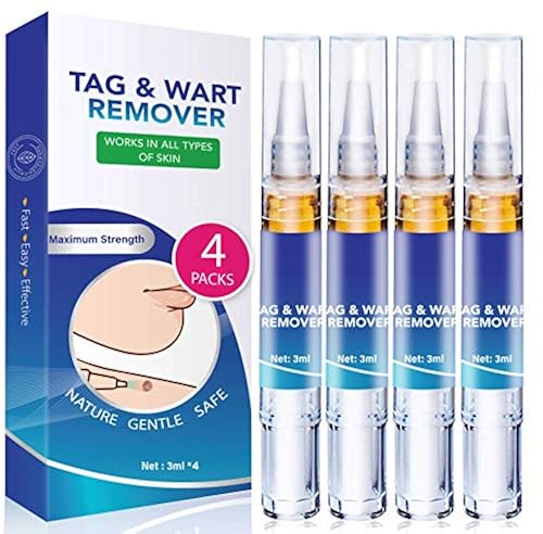 Skin Tag Remover - Wart Remover - Quickly Remove Common And Plantar ...