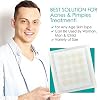 Sulphur Soap - Premium 10% Sulfur Advanced Wash for Acne. Natural Fresh ...