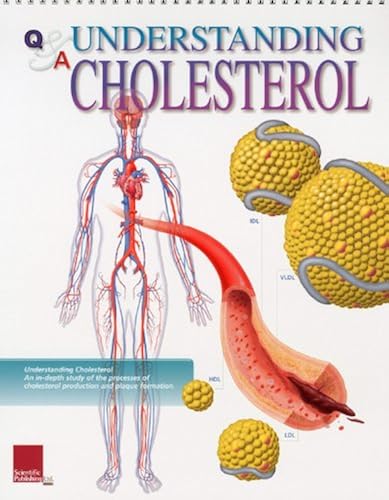 Understanding Cholesterol Flip Chart (Flip Charts) in Dubai - UAE ...
