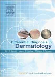 Differential Diagnosis in Dermatology: 9780323030175: Medicine & Health Science Books @ Amazon.com