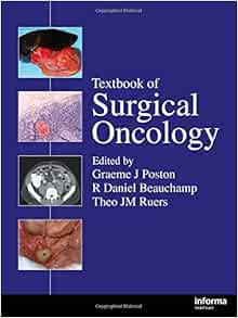 Textbook of Surgical Oncology: 9781841845074: Medicine & Health Science ...