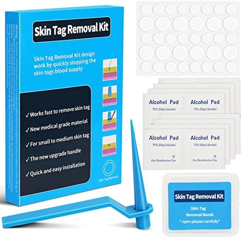 Micro Skin Tag Remover Kit - Painless Skin Tag Removal Tag Away Skin ...