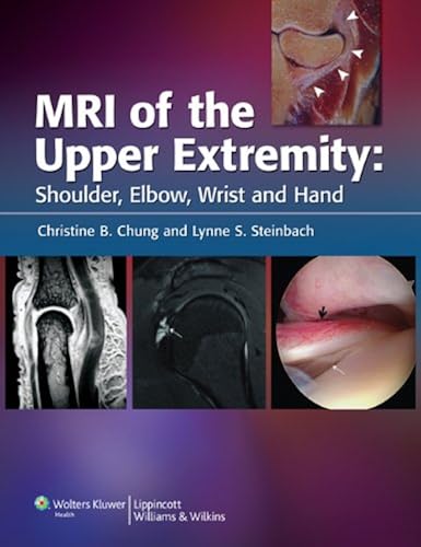 MRI of the Upper Extremity: Shoulder, Elbow, Wrist and Hand in Kuwait ...