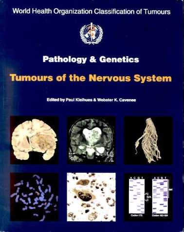 World Health Organization Classification of Tumours: Pathology and ...