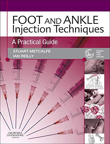 Foot and Ankle Injection Techniques: A Practical Guide: 9780702031076 ...
