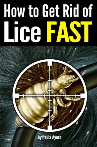 How to Get Rid of Lice FAST: An Essential Guide to Getting Rid of Head ...