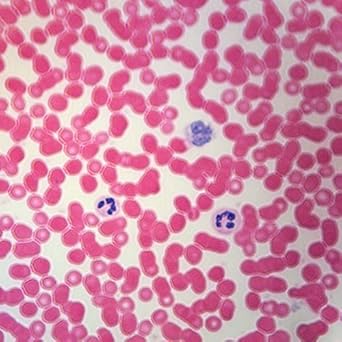 Human Blood Film Slide, Smear, H&E: Red Blood Cell Slides: Amazon.com ...