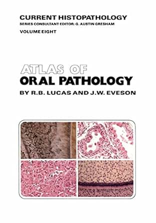 Atlas of Oral Pathology (Current Histopathology Book 8) - Kindle ...