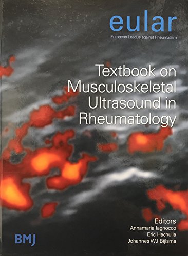 Eular Textbook on Musculoskeletal Ultrasound in Rheumatology: Annamaria ...