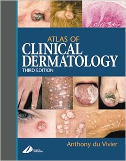 Atlas of Clinical Dermatology: Amazon.co.uk: Anthony du Vivier ...