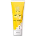 Amazon.com: Touch Benzoyl Peroxide 2.5% Acne Treatment Gel Cream ...