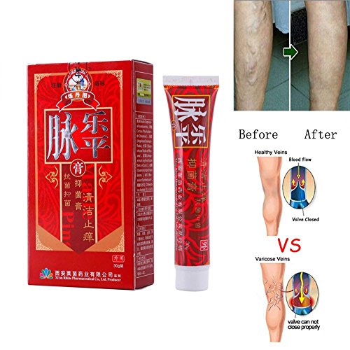 Buy Varicose Veins Cream 30g, Blood Vessel Care Venous Ointment Improve ...
