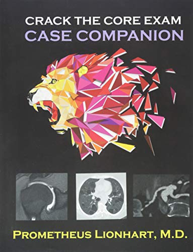 Crack the CORE Exam - Case Companion: 9781507810859: Medicine & Health ...
