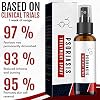 Alkyne Kolmax Vitiligo Relief Spray, Kolmax Psoriasis Relief Spray ...