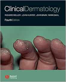 Clinical Dermatology: 9781405146630: Medicine & Health Science Books @ Amazon.com