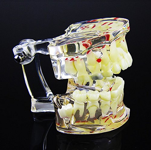 ChildrenTooth Model Dental Transparent Demonstration Child Kid's Teeth ...