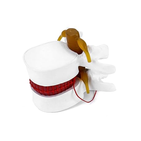 Mua QWORK Anatomical Human Lumbar Vertebrae Degenerative Spine Model ...
