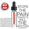 ToothKill - Toothkill Cavity Relief Cracked Tooth And Nerve Pain Gone ...