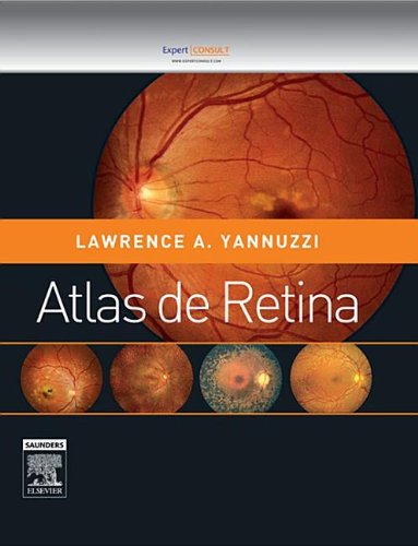 Atlas de Retina PDF Lawrence Yannuzzi