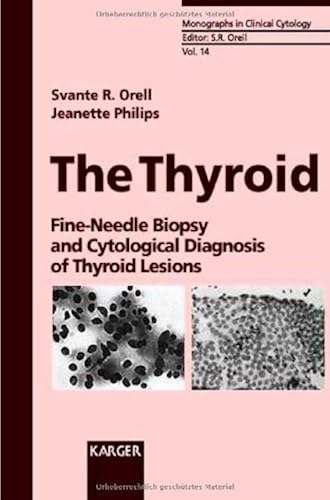 The Thyroid: Fine-Needle Biopsy and Cytological Diagnosis of Thyroid Lesions (MONOGRAPHS IN ...