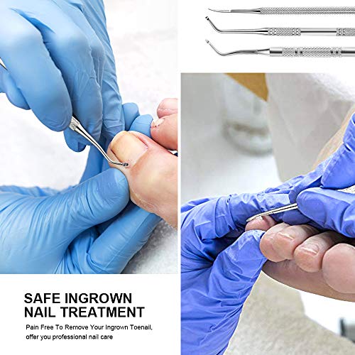 3pcs Ingrown toenail Tool, Toenail File and Lifters, [ Upgraded ...