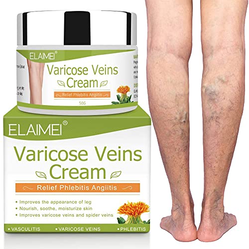 Varicose Veins Cream, Varicose Vein Soothing Leg Cream, Relief ...