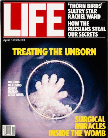 Mua LIFE Magazine April 1983 trên Amazon Mỹ chính hãng 2024 | Fado