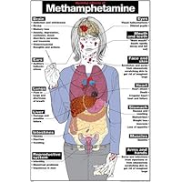 Amazon.com: Harmful Effects of Methamphetamine 24" X 36" Laminated ...