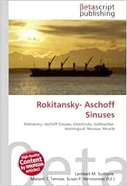 Rokitansky- Aschoff Sinuses: Rokitansky- Aschoff Sinuses, Diverticula ...