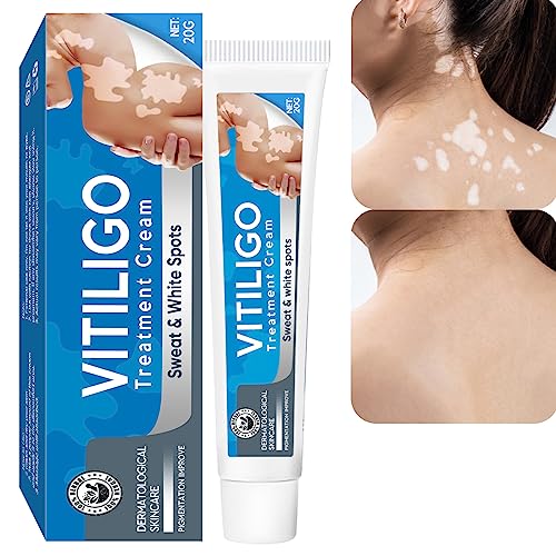 Yakitoko Vitiligo Cream, Vitiligo Treatment Cream Reduces White Spots ...
