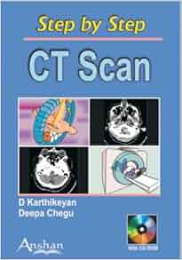 Step by Step Ct Scan (Step by Step (Anshan)): 9781904798811: Medicine ...