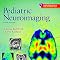 Pediatric Neuroimaging (Pediatric Neuroimaging (Barkovich ...