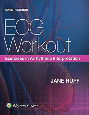 Amazon.com: ECG Workout: Exercises in Arrhythmia Interpretation eBook ...