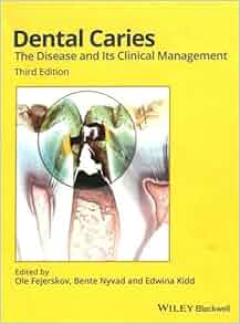 Dental Caries: The Disease and its Clinical Management: 9781118935828 ...