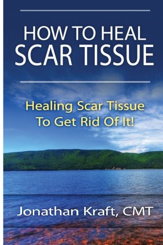 How to Heal Scar Tissue: How to Heal Your Own Scar Tissue And Get Rid ...