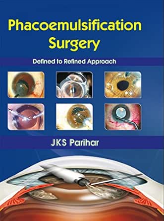 Phacoemulsification Surgery Defined to Refined Approach - Kindle ...