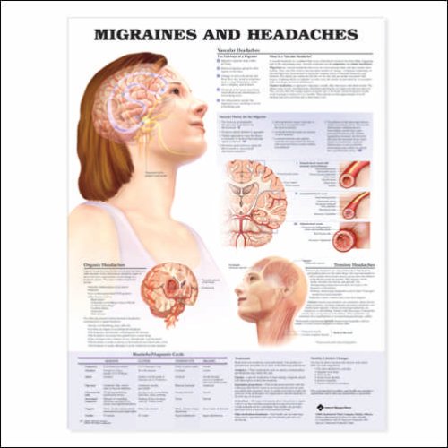 Amazon.com: Migraines and Headaches Anatomical Chart 20" X 26 ...