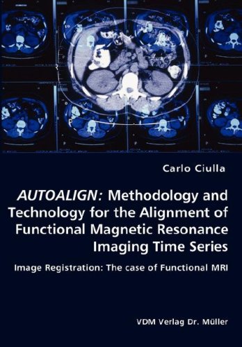 Buy AUTOALIGN: Methodology and Technology for the Alignment of ...