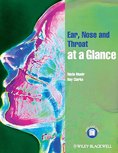 Ear, Nose and Throat at a Glance: 9781444330878: Medicine & Health ...