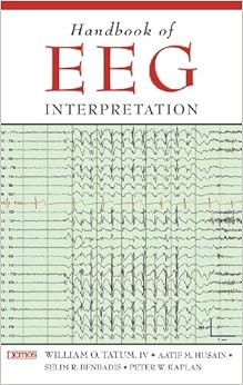 Handbook of EEG Interpretation: 9781933864112: Medicine & Health ...