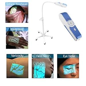 Amazon.com: Infrared Vein Finder Locator - FDA Approved Adult & Baby ...