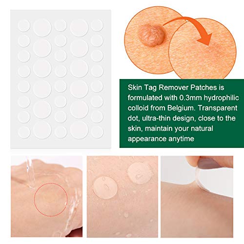 Skin Tag Remover Patches, Mole Remover, Acne Pimple Healing Patches ...