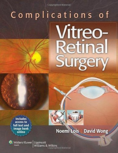 Complications of Vitreo-Retinal Surgery: 9781451119381: Medicine ...